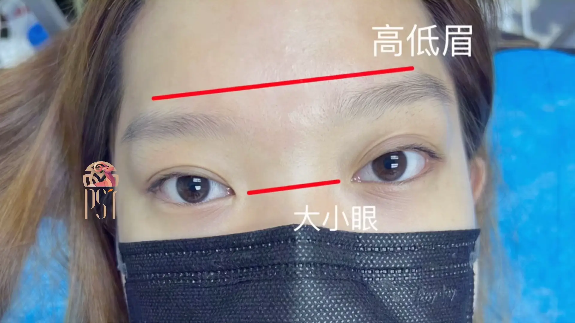 Alignment for IMBALANCE Brows | Video dipublikasikan oleh PST AESTHETIC | Lemon8
