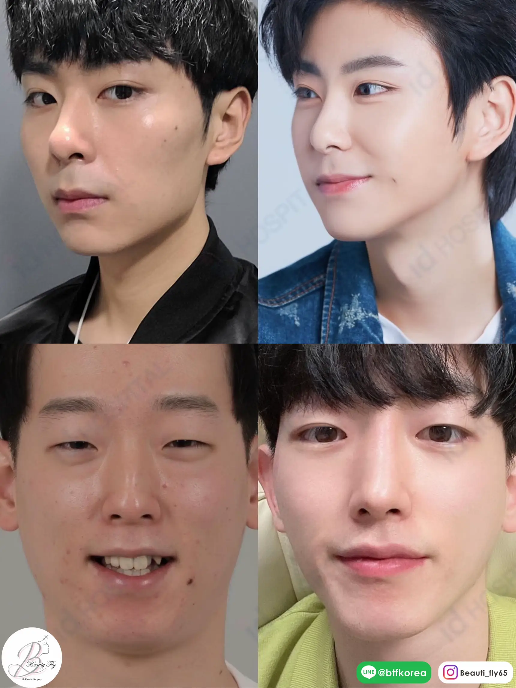 หล่อมาก | แกลเลอรีที่โพสต์โดย Noom BTF | Lemon8