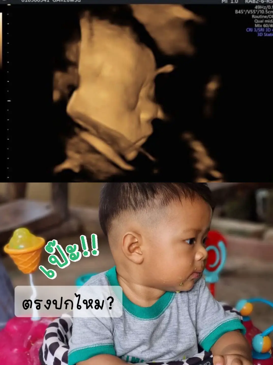 Q&A - 4D Scan ควรทำช่วงไหน ตรงปกไหมนะ? | แกลเลอรีที่โพสต์โดย Stardust 💫 ...