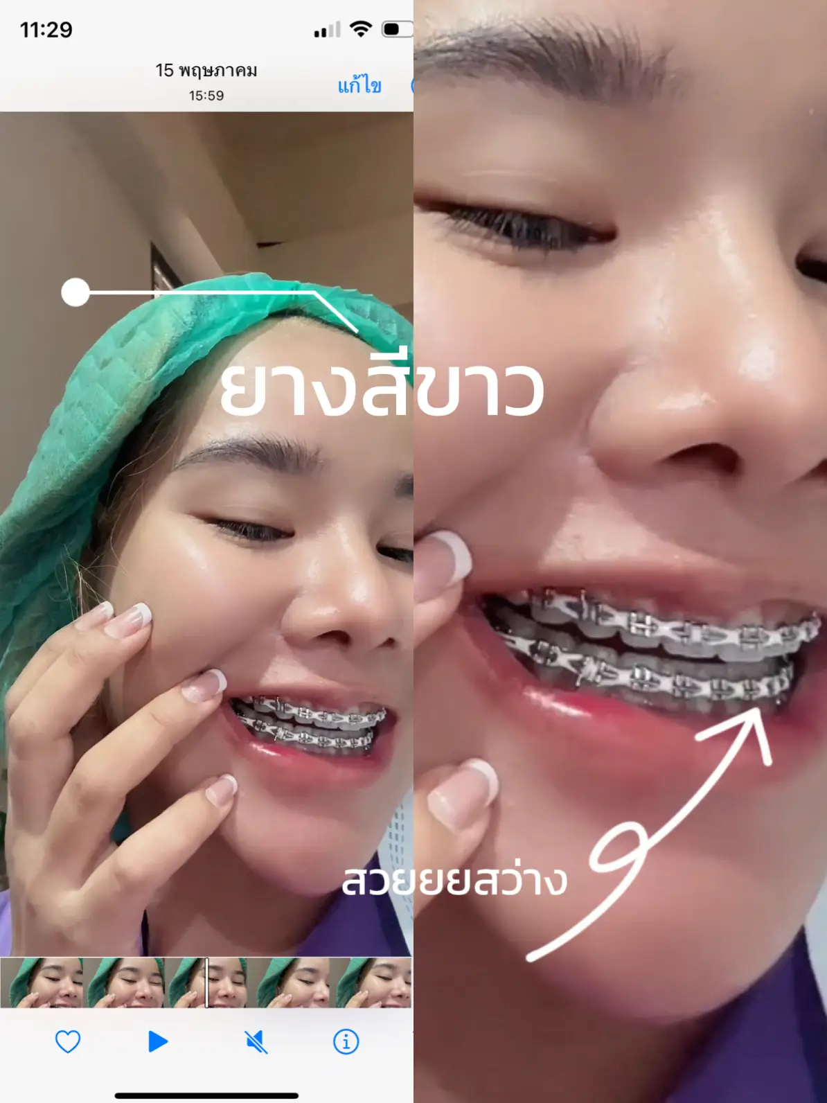 ยางสีขาว | แกลเลอรีที่โพสต์โดย So'lo | Lemon8