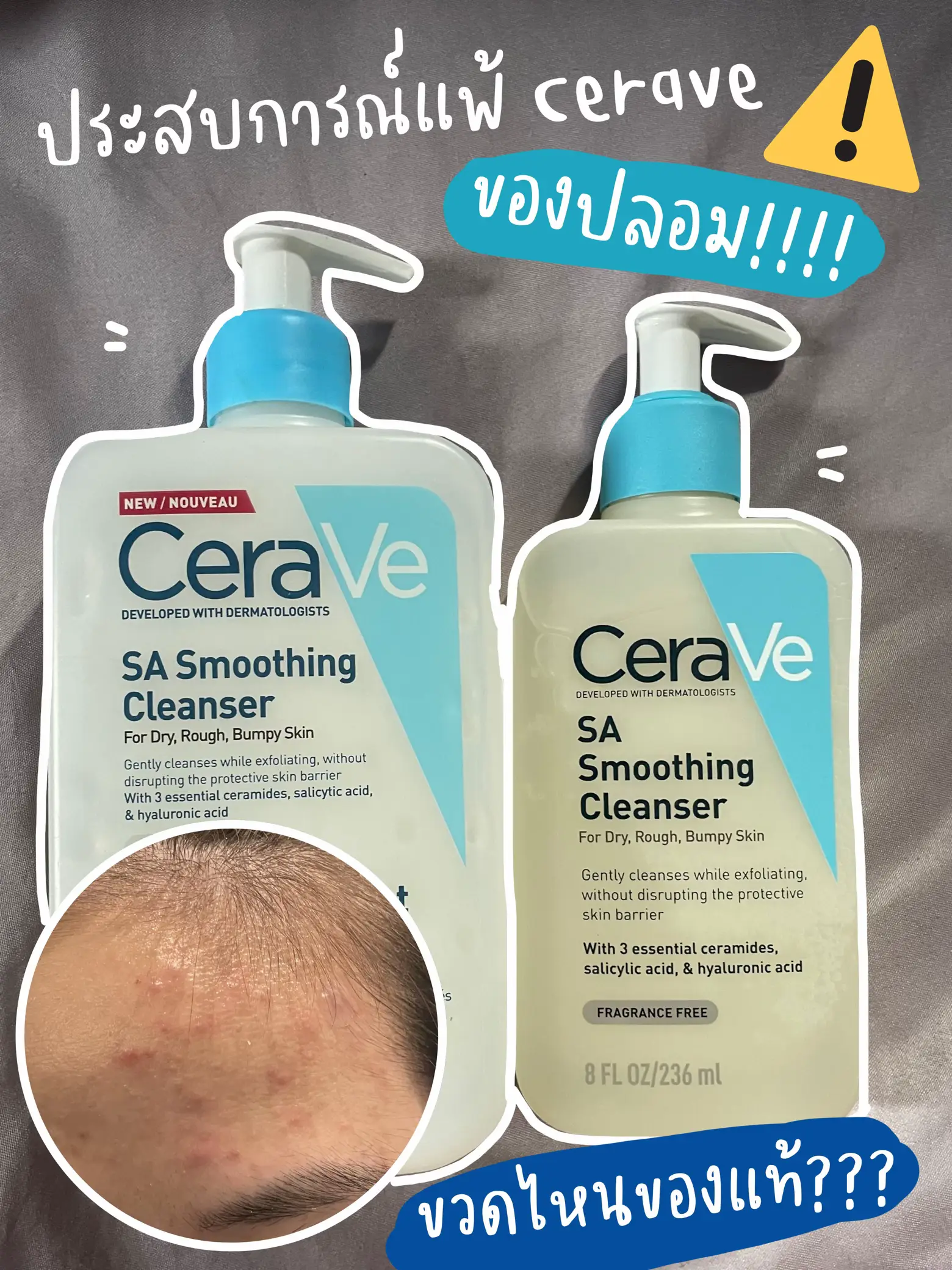 Cerave แท้ vs ปลอม จุดสังเกตง่ายมาก ก่อนที่หน้าจะพัง💥💥 | แกลเลอรีที่โพสต์โดย Mommam Junsudch ...