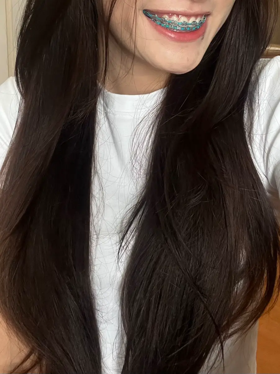 สียางจัดฟันที่ชอบที่สุด | แกลเลอรีที่โพสต์โดย Phannida | Lemon8