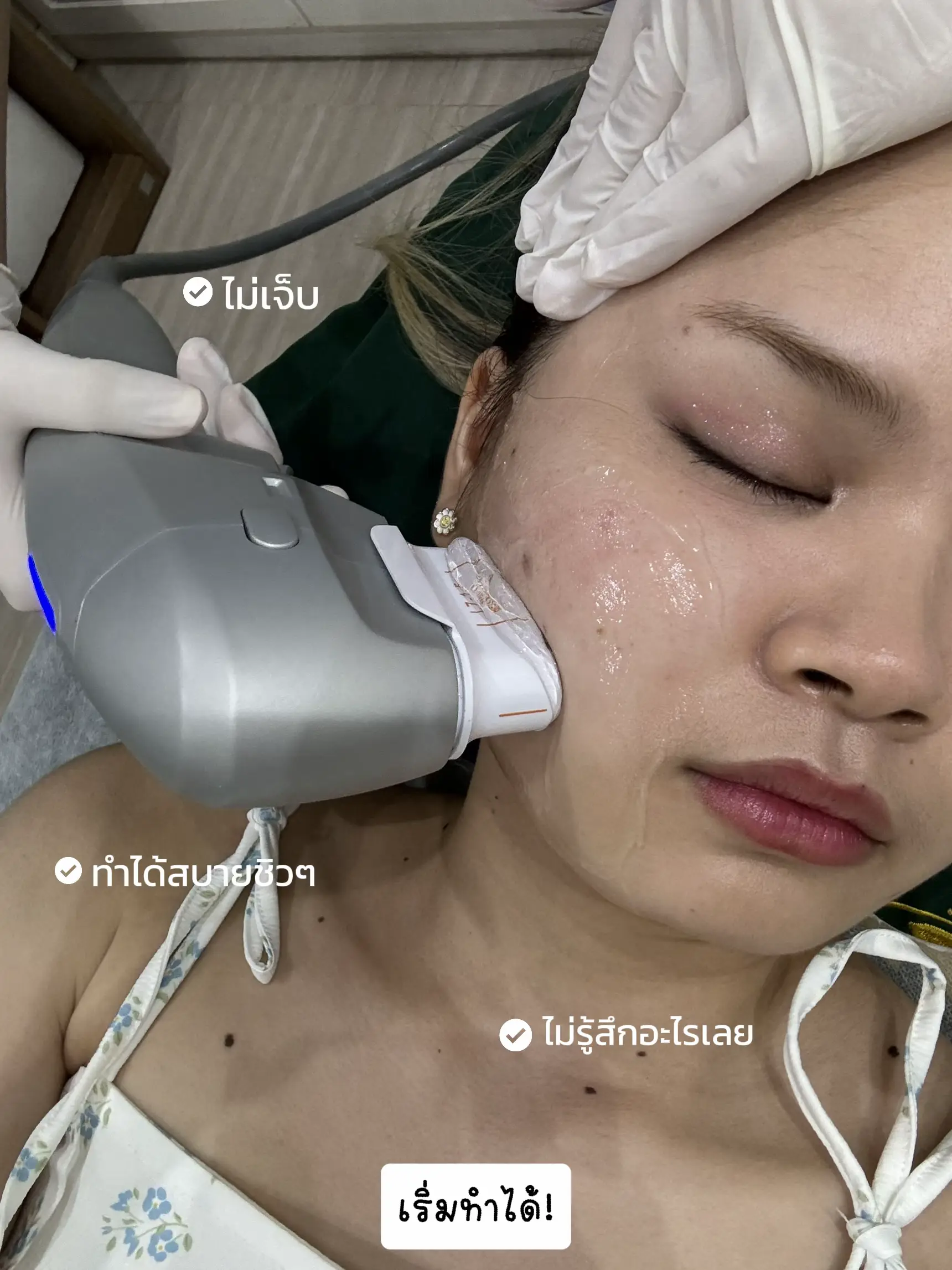 Cher Clinic รีวิวการทำ Hifu ในงบ 1 แบงค์เทา💸 | แกลเลอรีที่โพสต์โดย JaJah | Lemon8