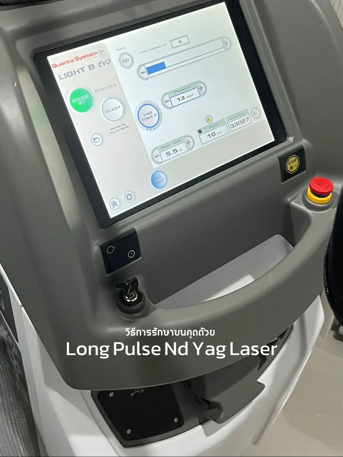 HOW TO รักษาขนคุดด้วย Long Pulse Nd Yag Laser | แกลเลอรีที่โพสต์โดย ...