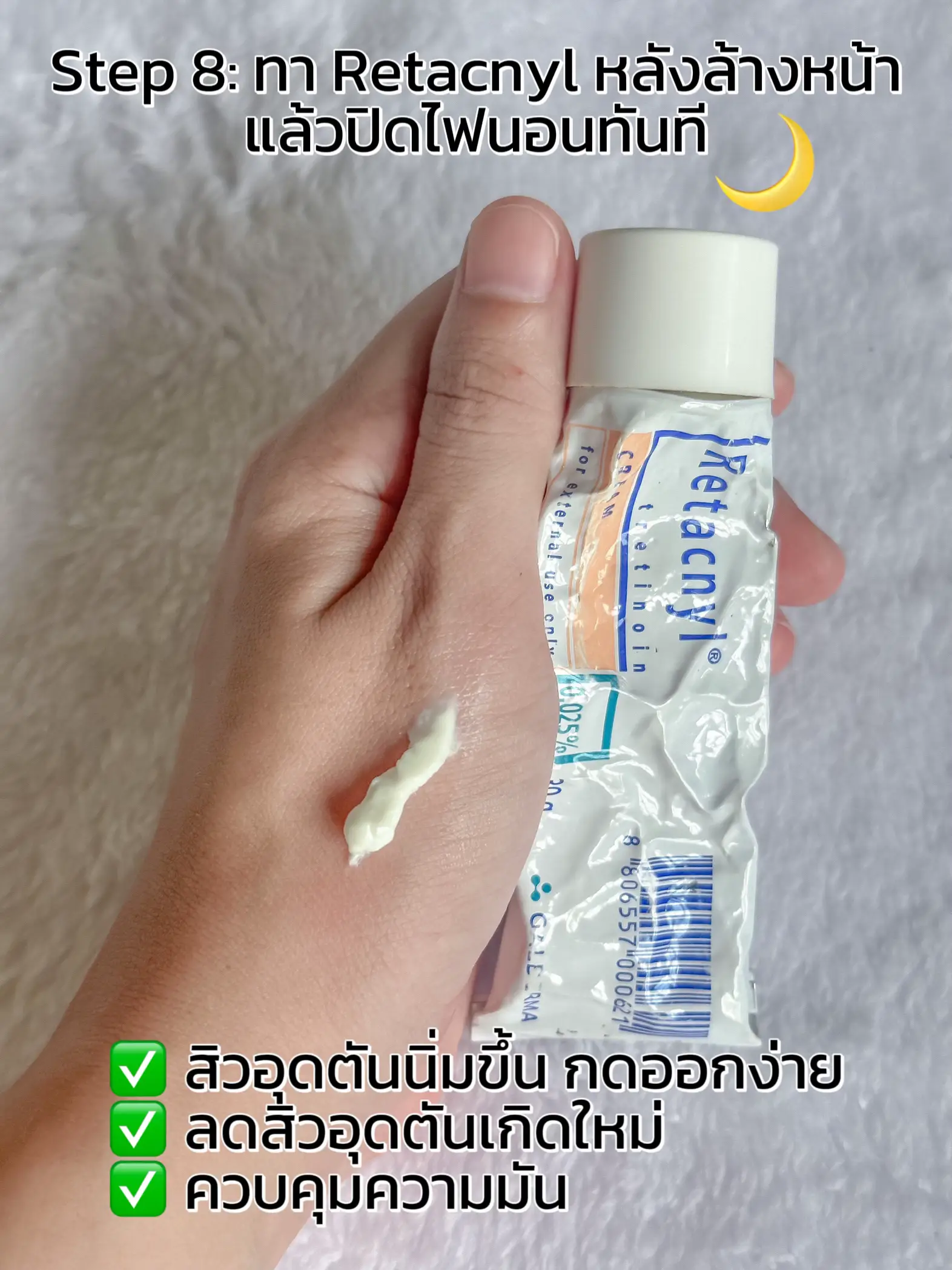 แชร์ทริค 8 ขั้นตอนเคลียร์ “สิว” #สาวผิวมัน🙌 | แกลเลอรีที่โพสต์โดย j ...