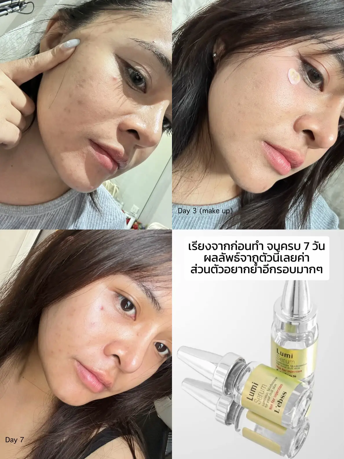 รีวิวจิ้ม Meso Celine | แกลเลอรีที่โพสต์โดย Muki.review | Lemon8