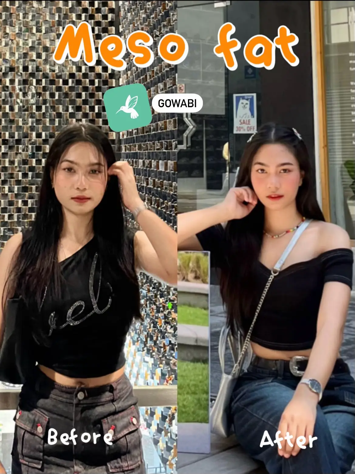 Meso fat ราคาเป็นมิตร💉🌟 | แกลเลอรีที่โพสต์โดย Erne🍅 | Lemon8