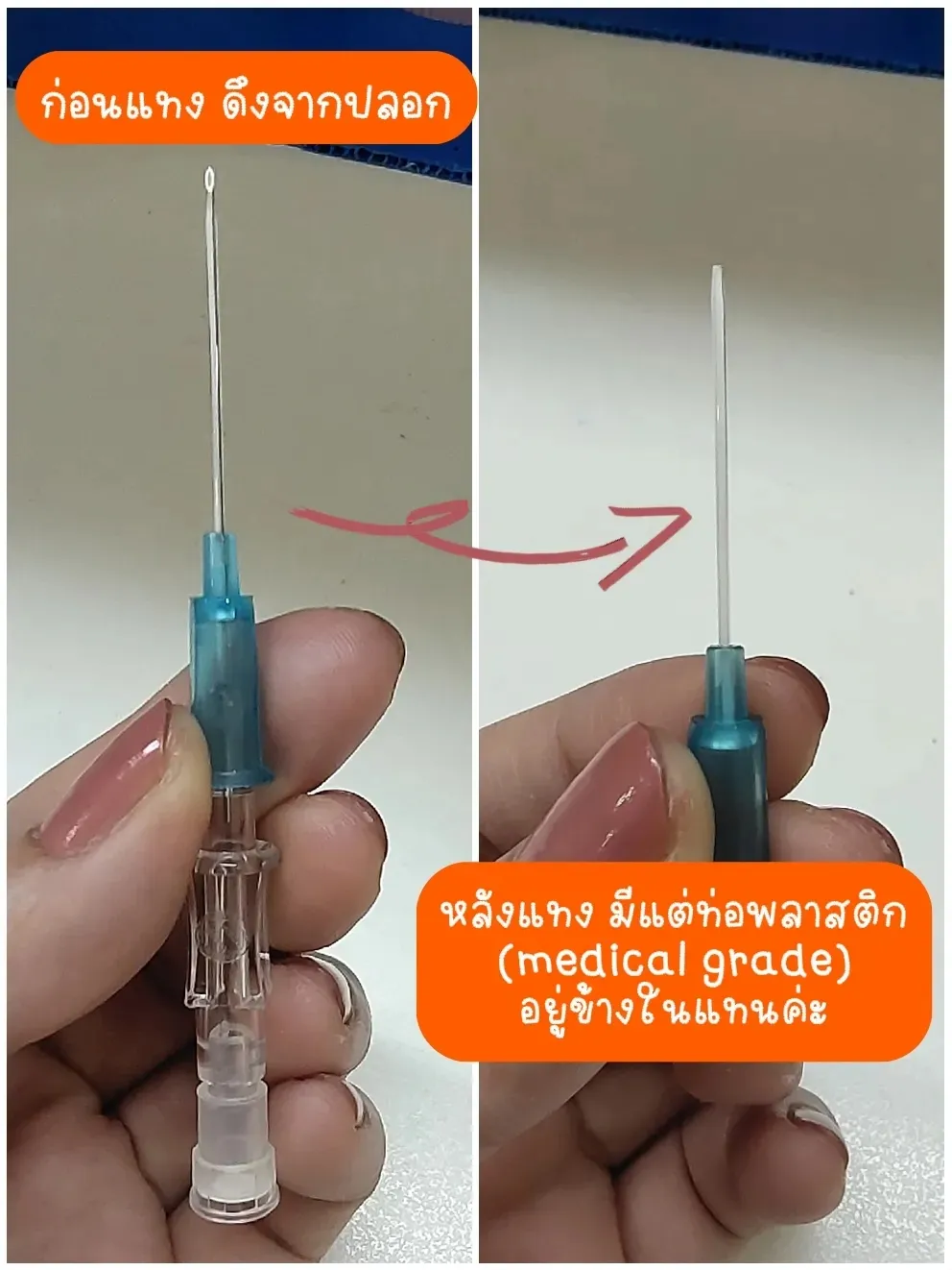 เข็มแทงน้ำเกลือ ยังมีเข็มอยู่ข้างในมั้ยคะ? | แกลเลอรีที่โพสต์โดย ...