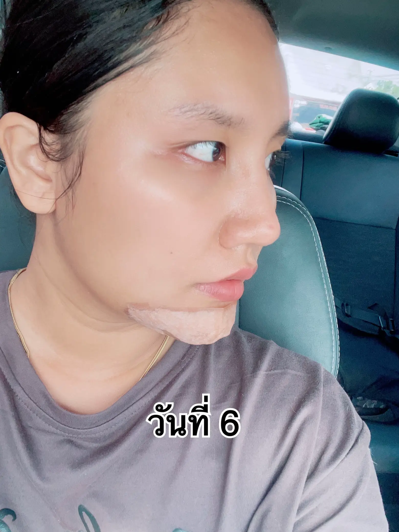 รีวิวทำคาง | แกลเลอรีที่โพสต์โดย Aui The word 🌎🍫🍩🥨🍦 | Lemon8