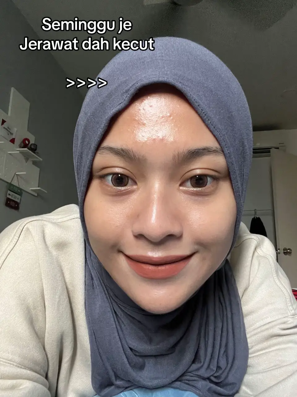 Acne-fighters kumpul sini💪 | Gallery posted by DrWana | Lemon8