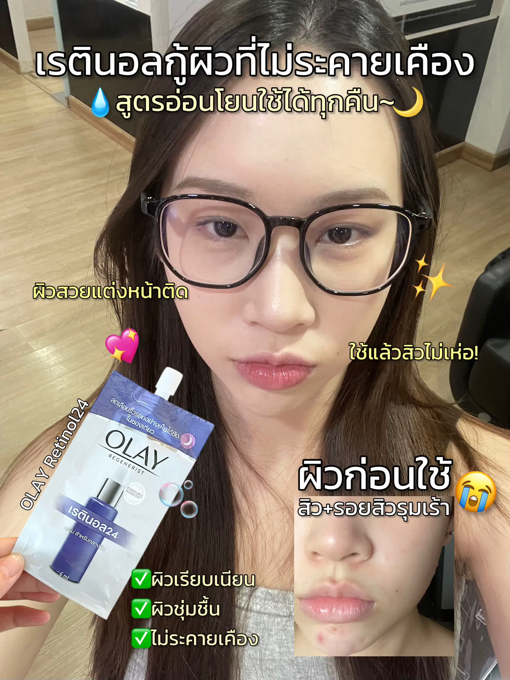 เรตินอล 3 ยี่ห้อ ใช้ดีใน 7-11 | แกลเลอรีที่โพสต์โดย NW | Lemon8