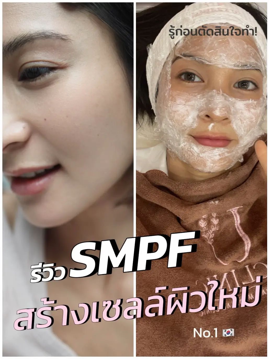 ลองนวัตกรรมล่าสุด สร้างเซลล์ผิวใหม่ให้อิ่มฟูดูเด็กลงด้วย SMPF | แกลเลอรีที่โพสต์โดย Nae ...