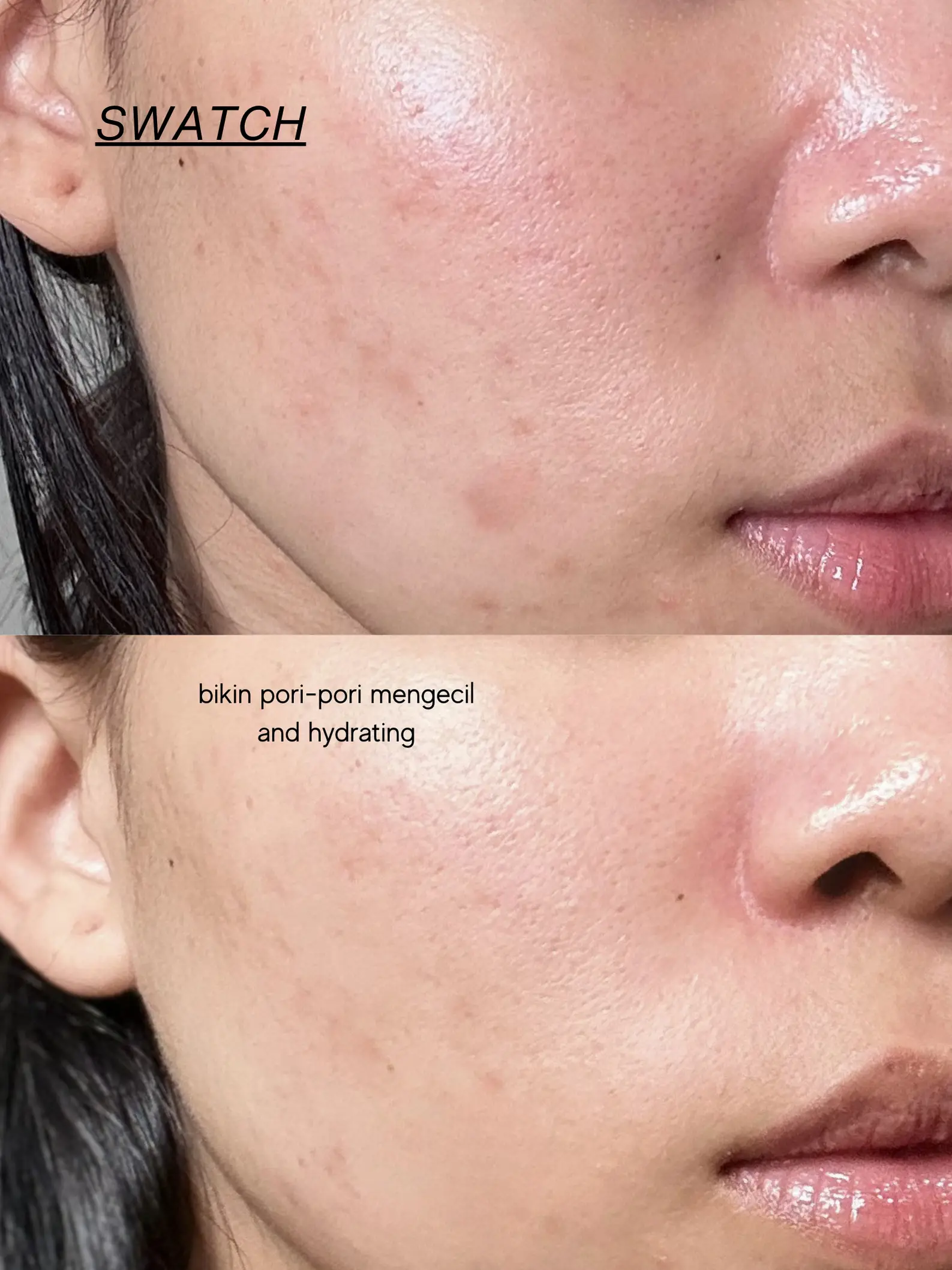 AVATAR - OIL CONTROL AND PORE BLOCKAGE 🧜🏻‍♀️ | Galeri diposting oleh ...