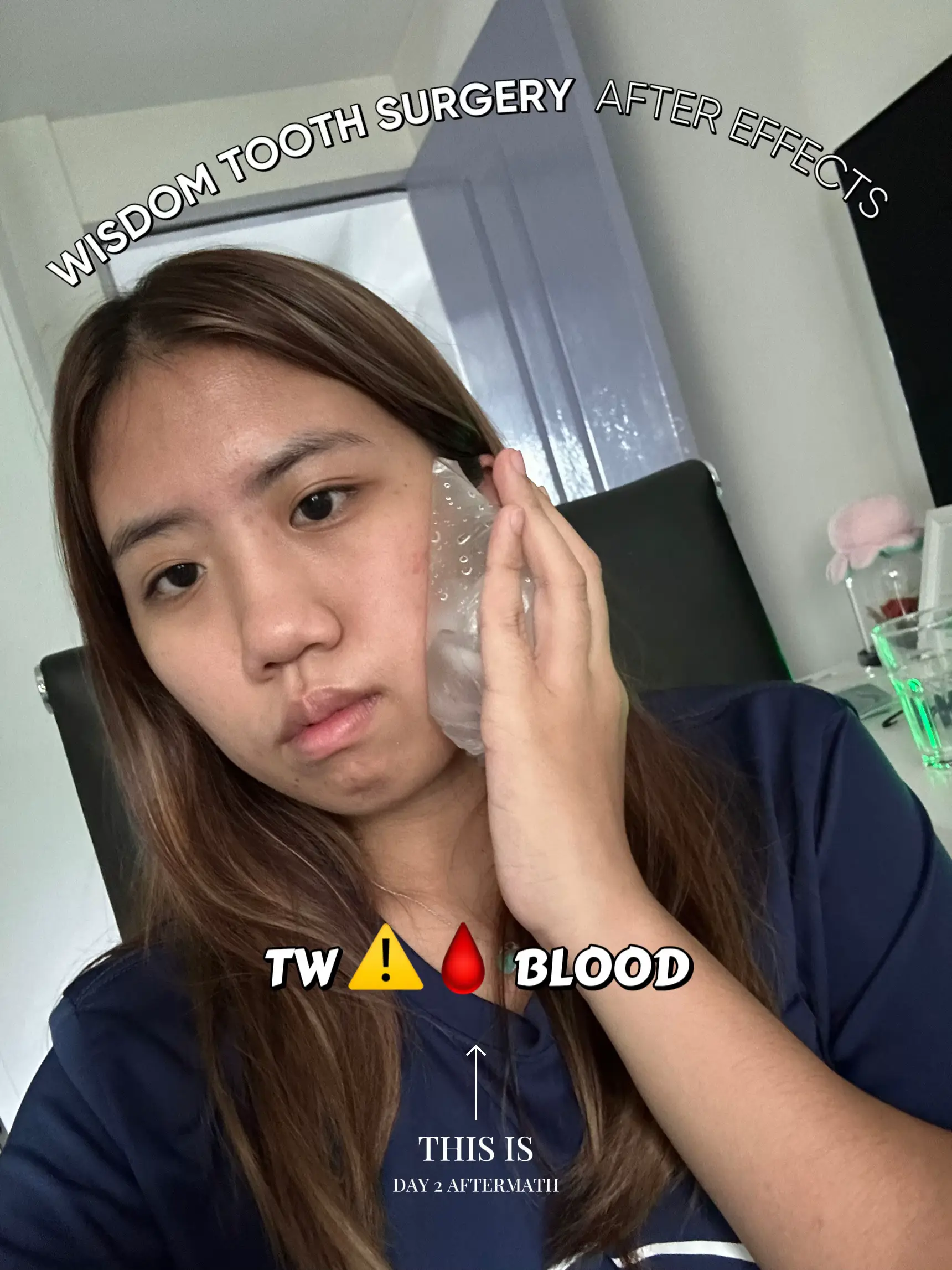 What are complications of wisdom teeth removal? | 2025 real user experience on Lemon8