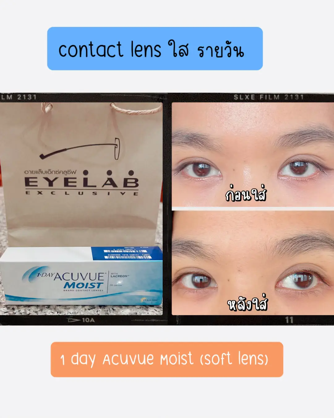1 day Acuvue Moist 💧 Contact lens ใส รายวัน | แกลเลอรีที่โพสต์โดย ...