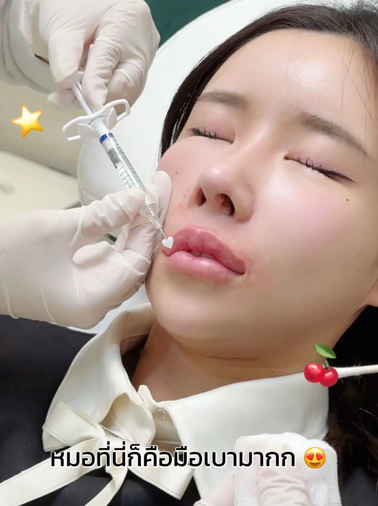 Filler ปากแค่ 1cc แต่ได้ปากฉ่ำสุด ๆ 🍒 | แกลเลอรีที่โพสต์โดย Hello muse 🪄 | Lemon8