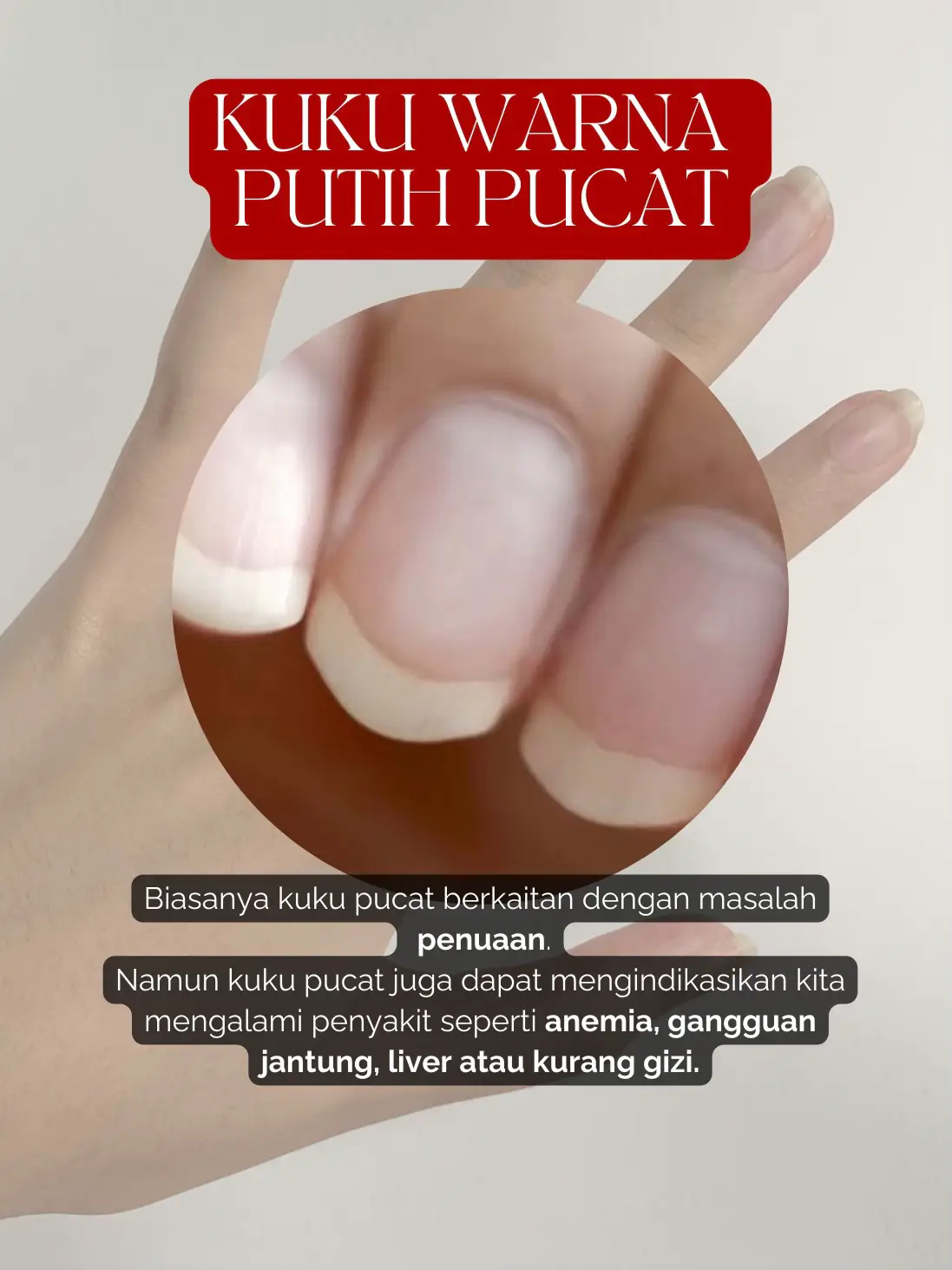 WARNA KUKU TUNJUKKAN KONDISI KESEHATANMU!⚠️😱 | Galeri diposting oleh Charmine🤍 | Lemon8