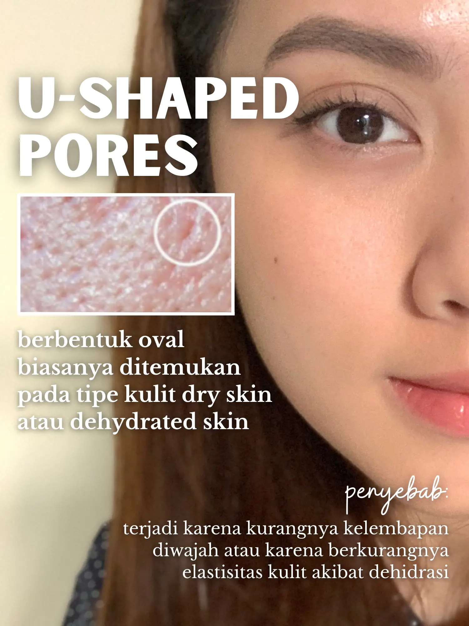 Kenali jenis pori-pori! Kamu yang mana nih?🫣 | Galeri diposting oleh ...