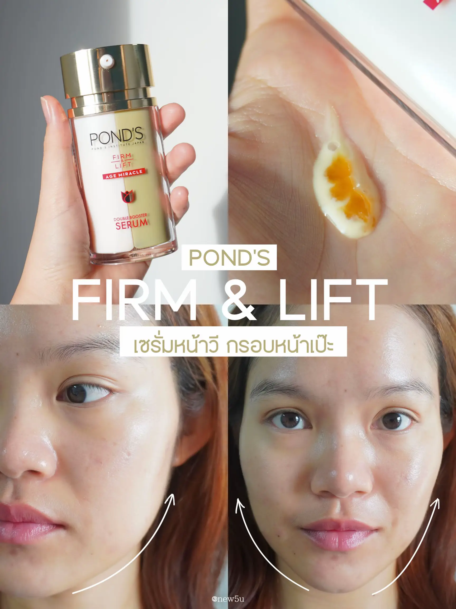 POND’S เซรั่มหน้าวี กรอบหน้าเป๊ะ | แกลเลอรีที่โพสต์โดย นิวสไตล์☄️ | Lemon8