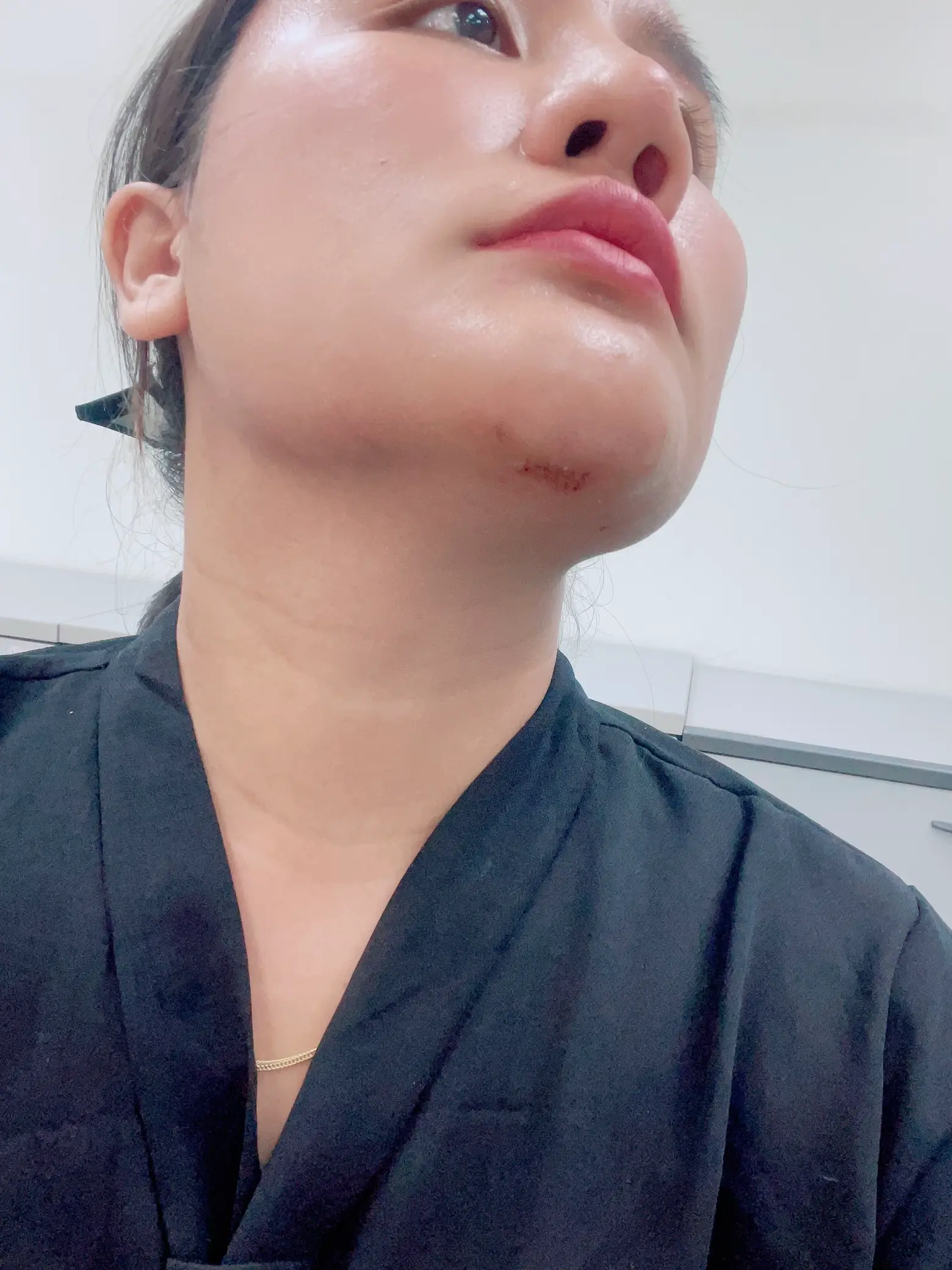 รีวิวทำคาง | แกลเลอรีที่โพสต์โดย Aui The word 🌎🍫🍩🥨🍦 | Lemon8