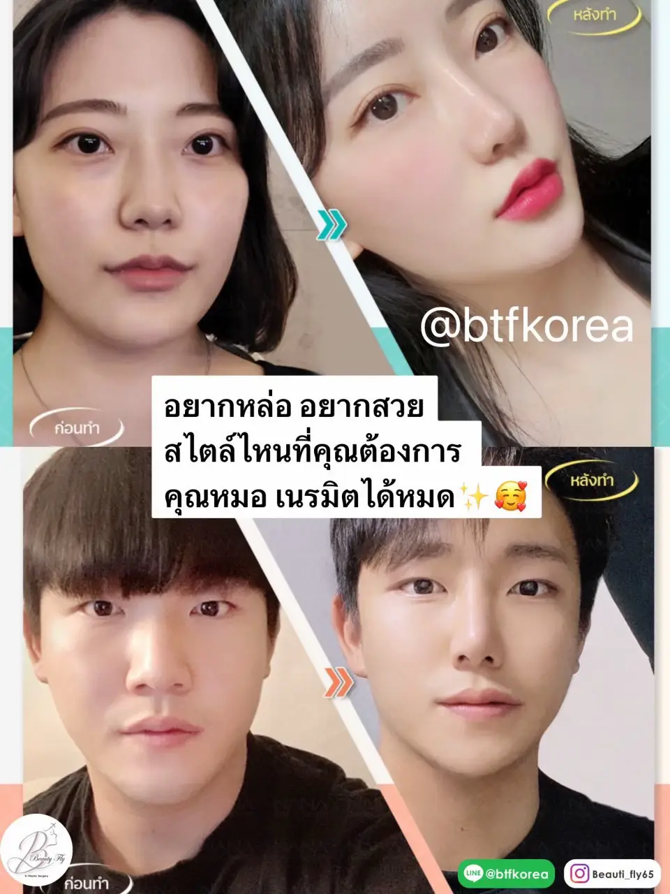 รีวิวศัลยกรรมเกาหลี | แกลเลอรีที่โพสต์โดย Noom BTF | Lemon8