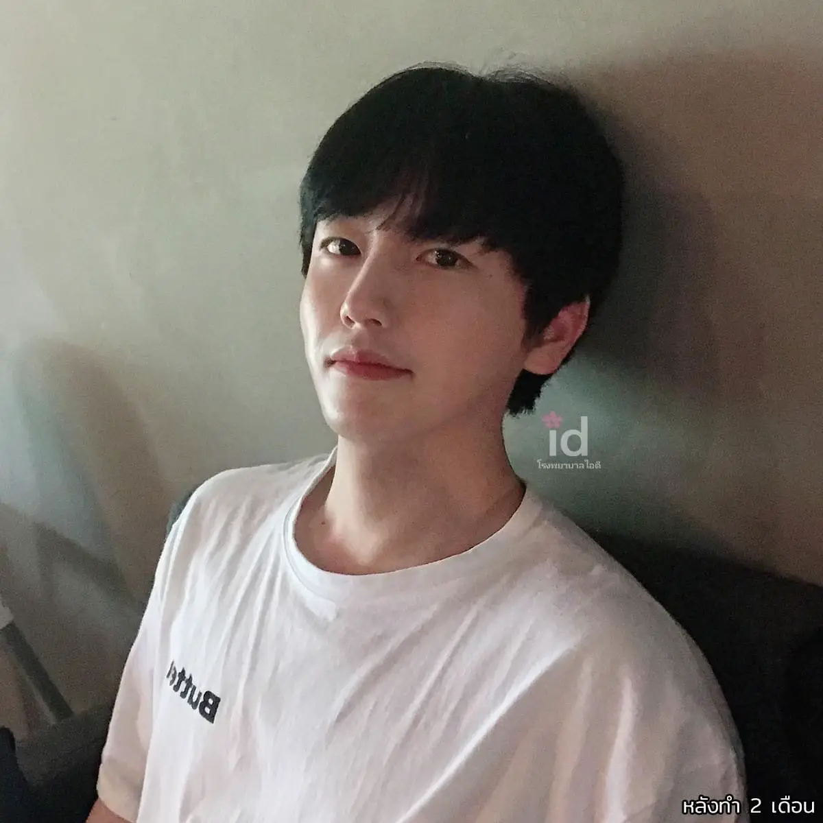 ศัลยกรรมผู้ชาย | แกลเลอรีที่โพสต์โดย Noom BTF | Lemon8