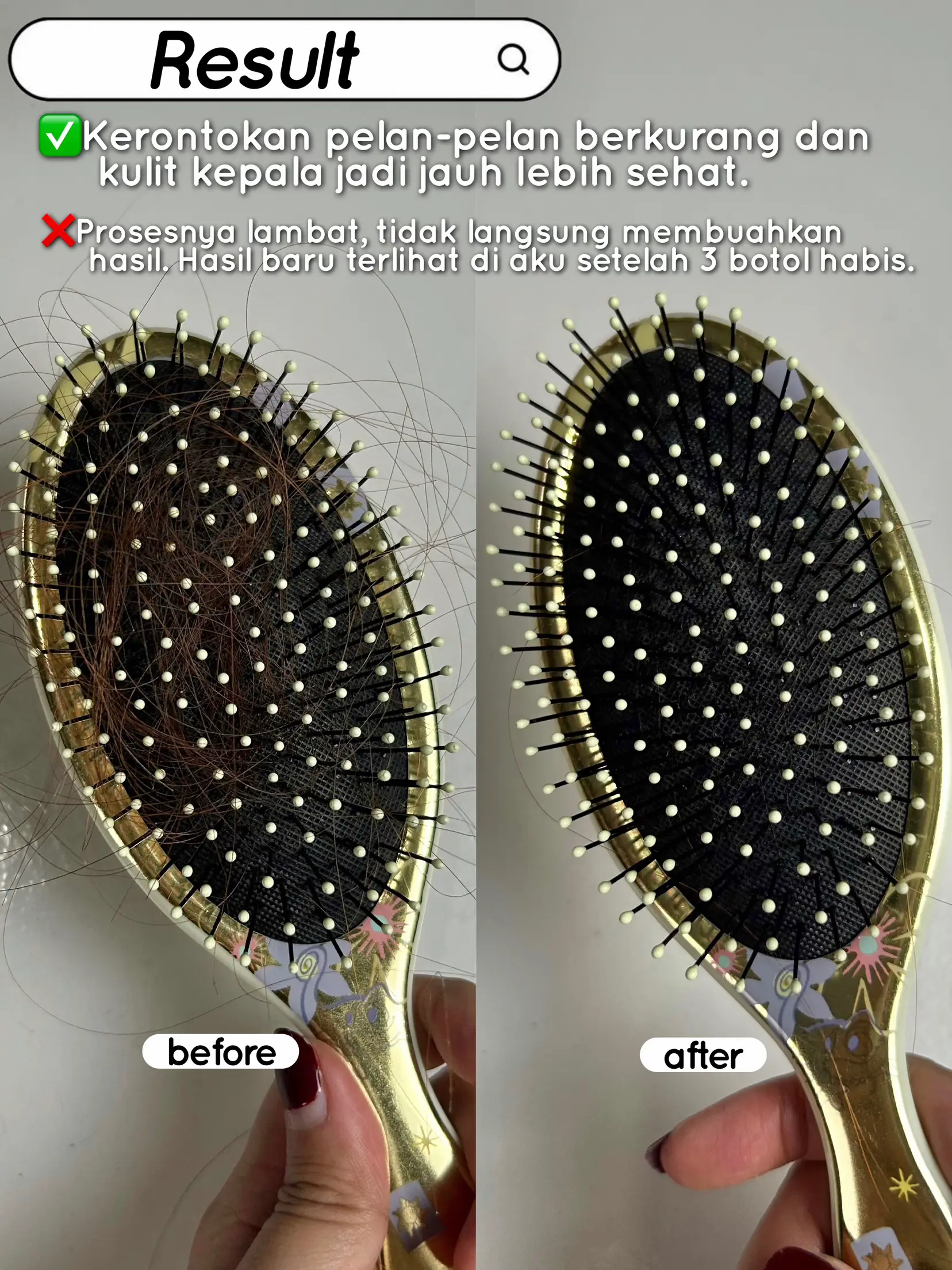 REVIEW HAIR TONIK BEST SELLER BUAT RAMBUT RONTOK😍 | Galeri diposting ...