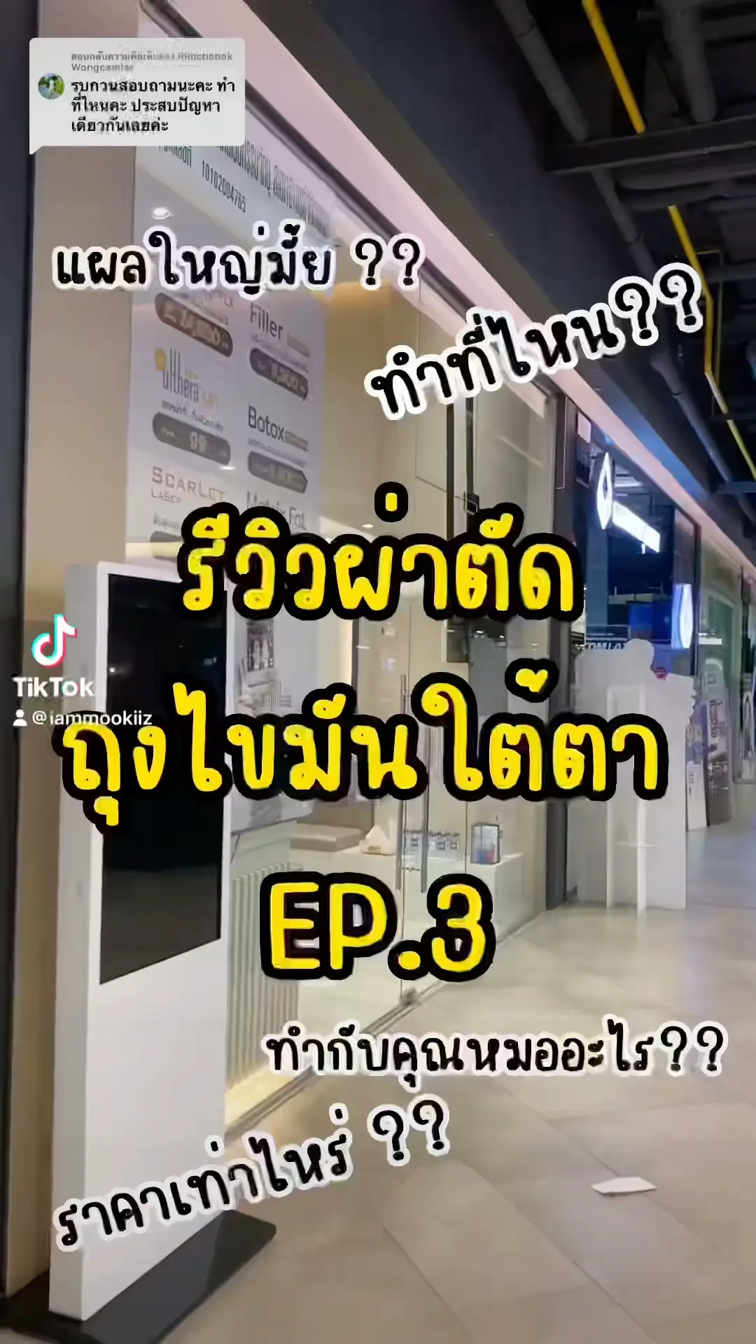 รีวิวดูดถุงไขมันใต้ตา Ep.3 มาแล้วค่า | วิดีโอที่เผยแพร่โดย Mook:) | Lemon8