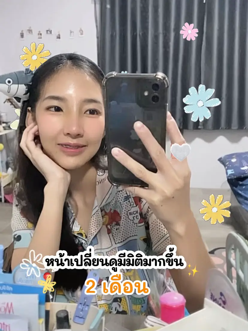 รีวิวศัลยกรรมครั้งแรก ฉบับคนเนื้อน้อย | แกลเลอรีที่โพสต์โดย Popla 🐳 | Lemon8