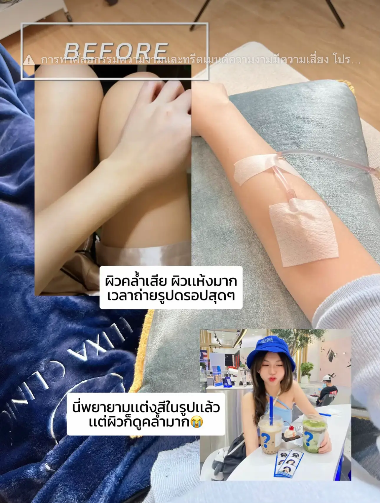ดริปผิวใส เเค่4ครั้งผลลัพธ์??!!⭐️ | แกลเลอรีที่โพสต์โดย Muay💐 | Lemon8