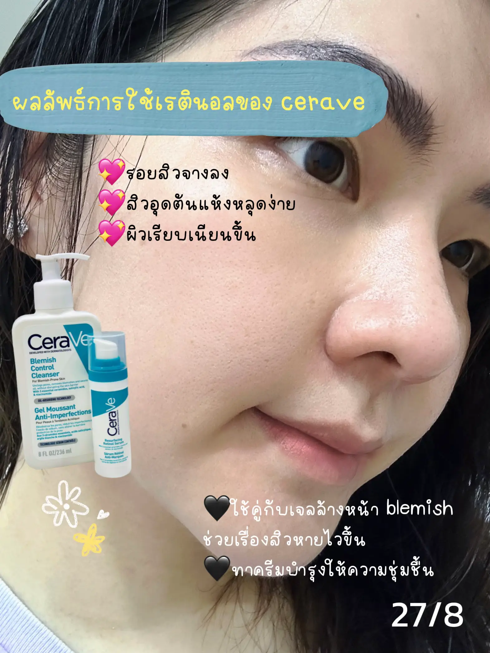 เรตินอลที่คนผิวแพ้ง่ายใช้ได้😍 | แกลเลอรีที่โพสต์โดย realmin | Lemon8