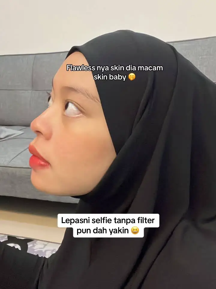 Arghhh jerawat !!! | Galeri disiarkan oleh Amira mohd | Lemon8