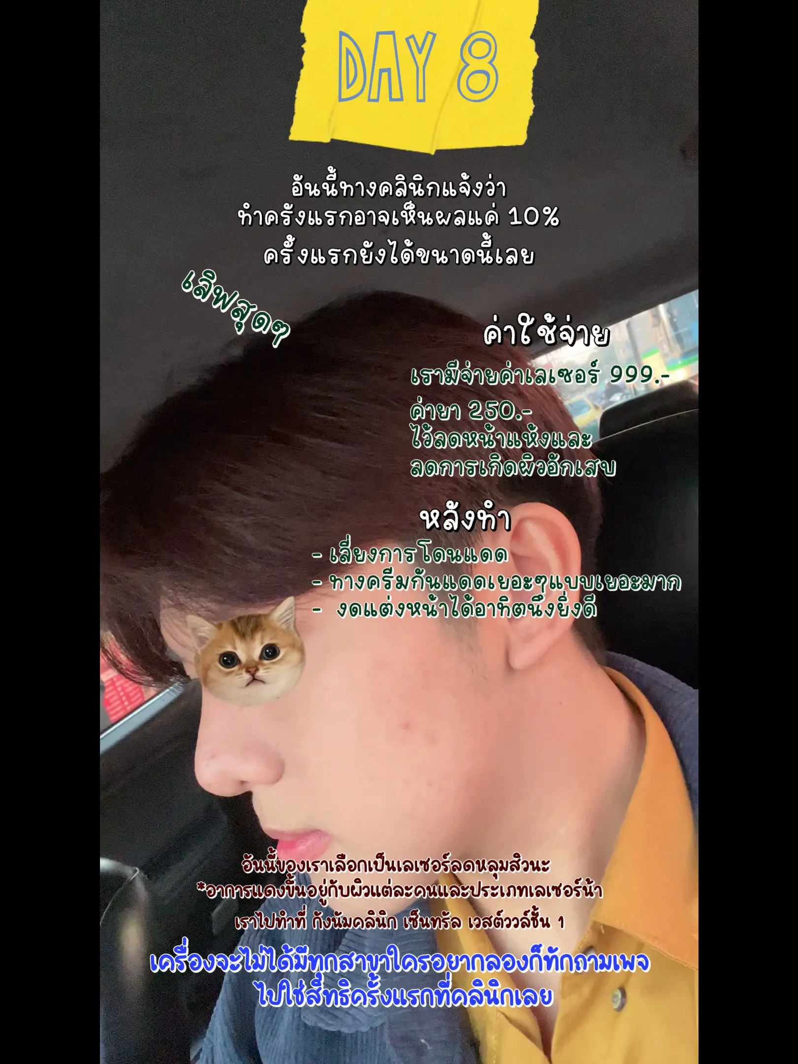 999ピコレーザーを支払う | ปันประสาทが投稿したフォトブック | Lemon8