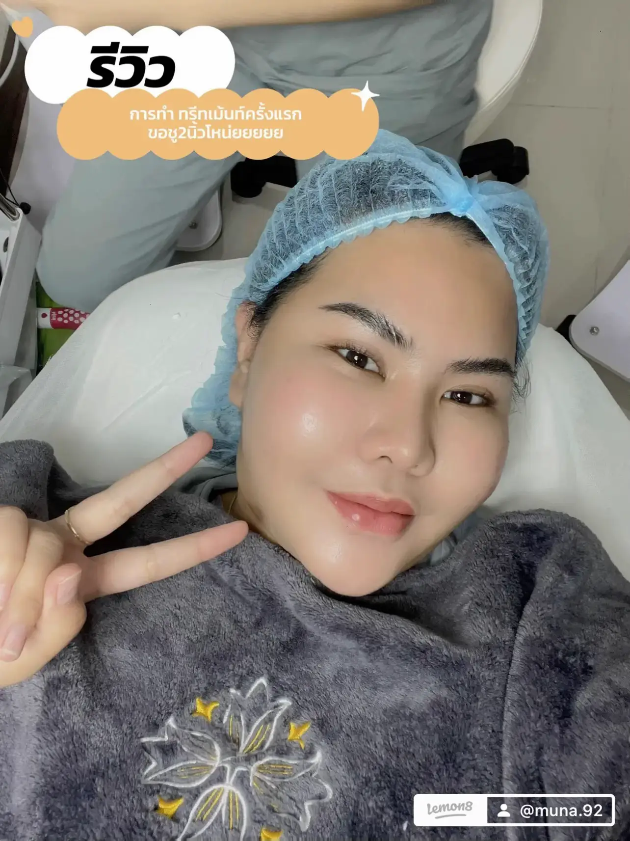 รักษาสิวแบบ 4ขั้นตอน | แกลเลอรีที่โพสต์โดย MUNA | Lemon8