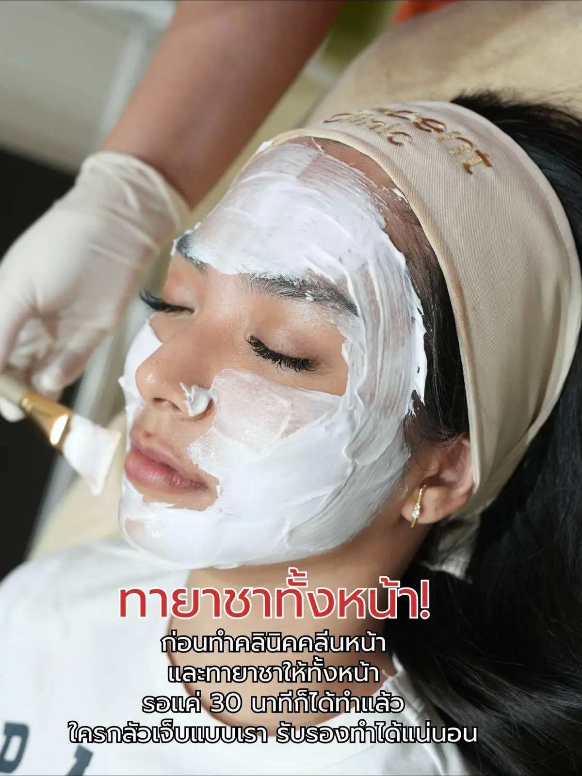 Pico Laser หน้าเนียน รอยสิวหาย! | แกลเลอรีที่โพสต์โดย Nurse knt | Lemon8