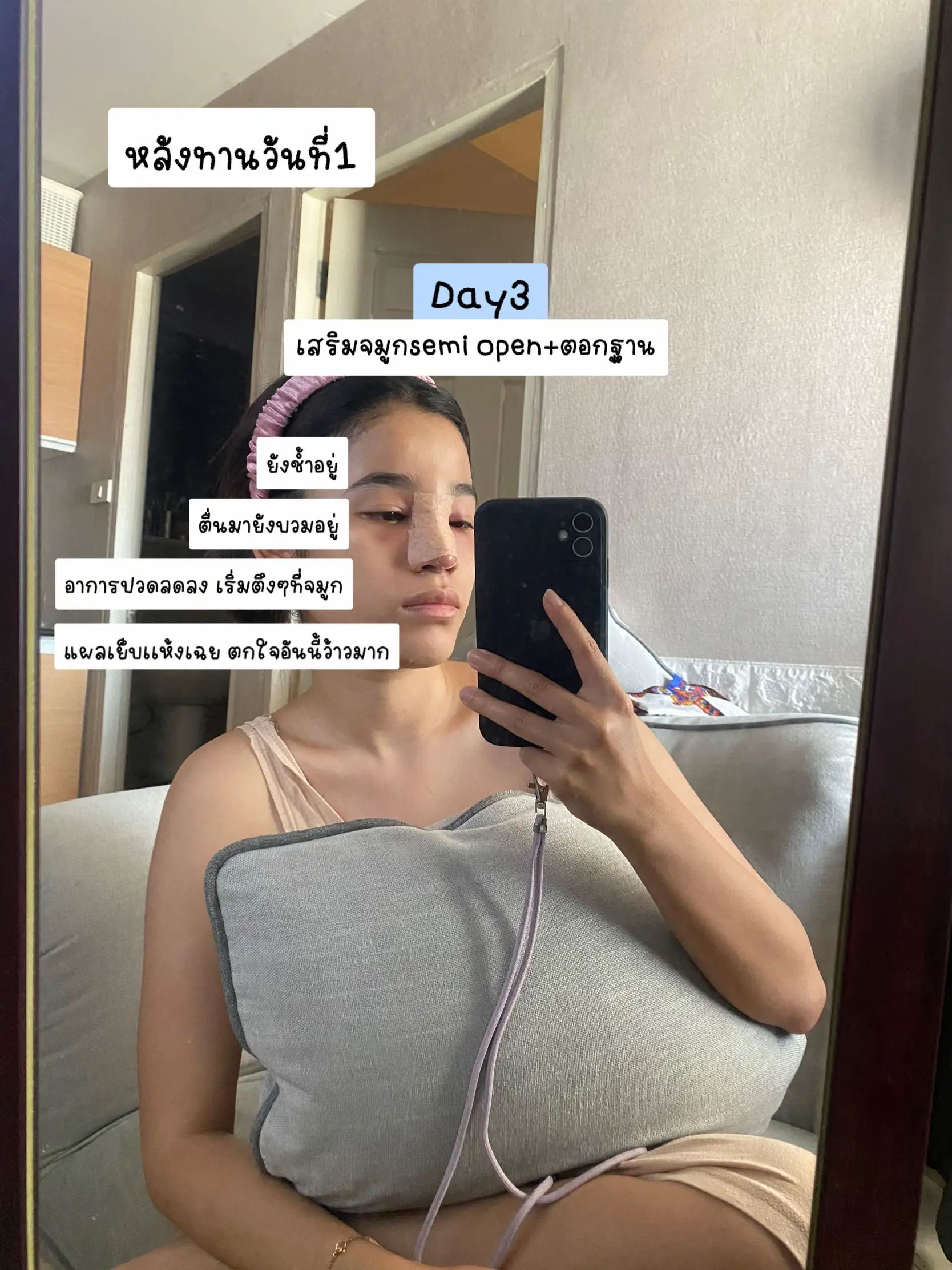 ลดบวม Proctase-P คือ ยา แก้ อะไร - การค้นหาใน Lemon8