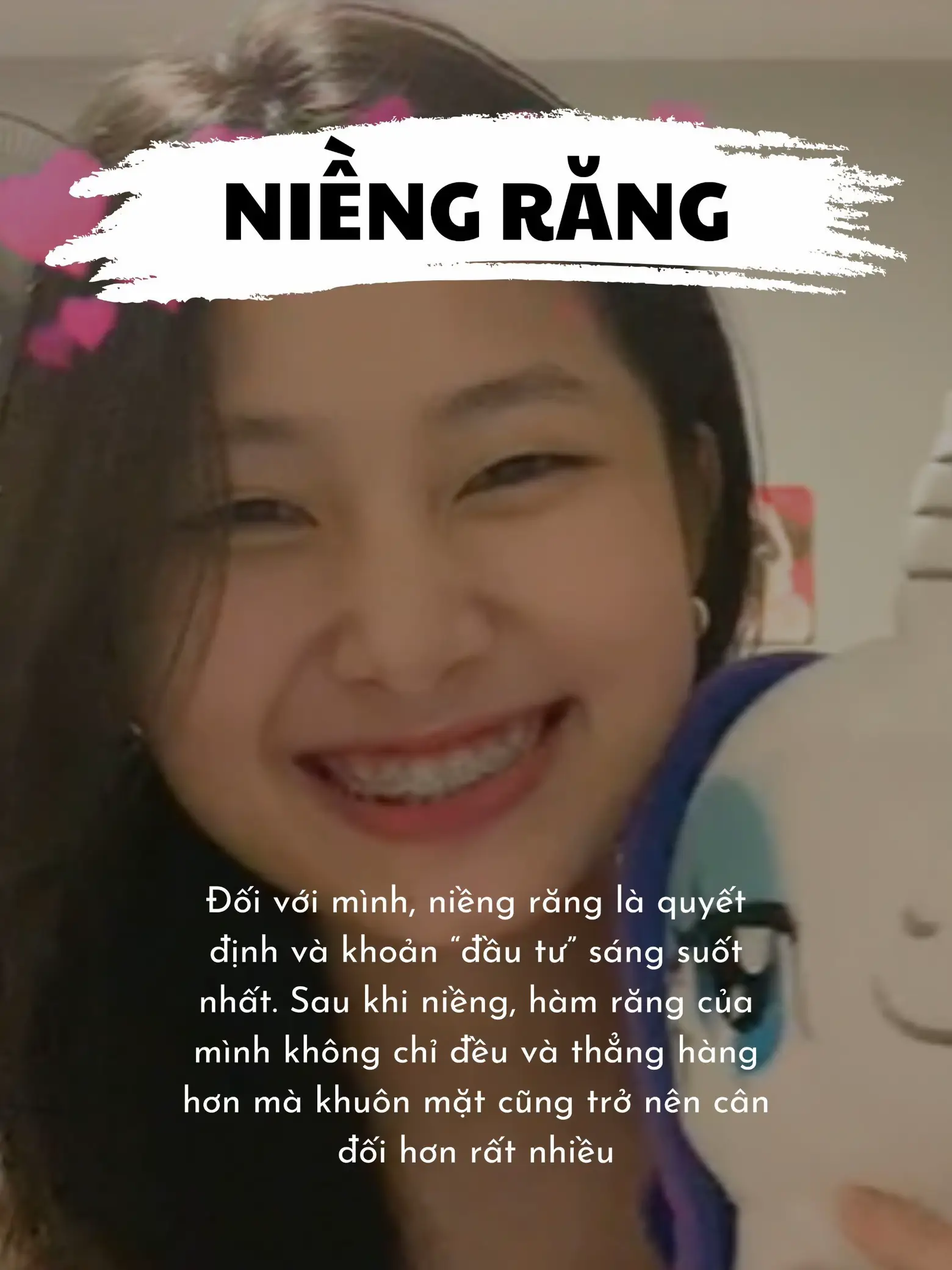 CÁCH MÌNH CẢI THIỆN MẶT LỆCH 🌷 | Bộ sưu tập do Pham Ha My đăng | Lemon8