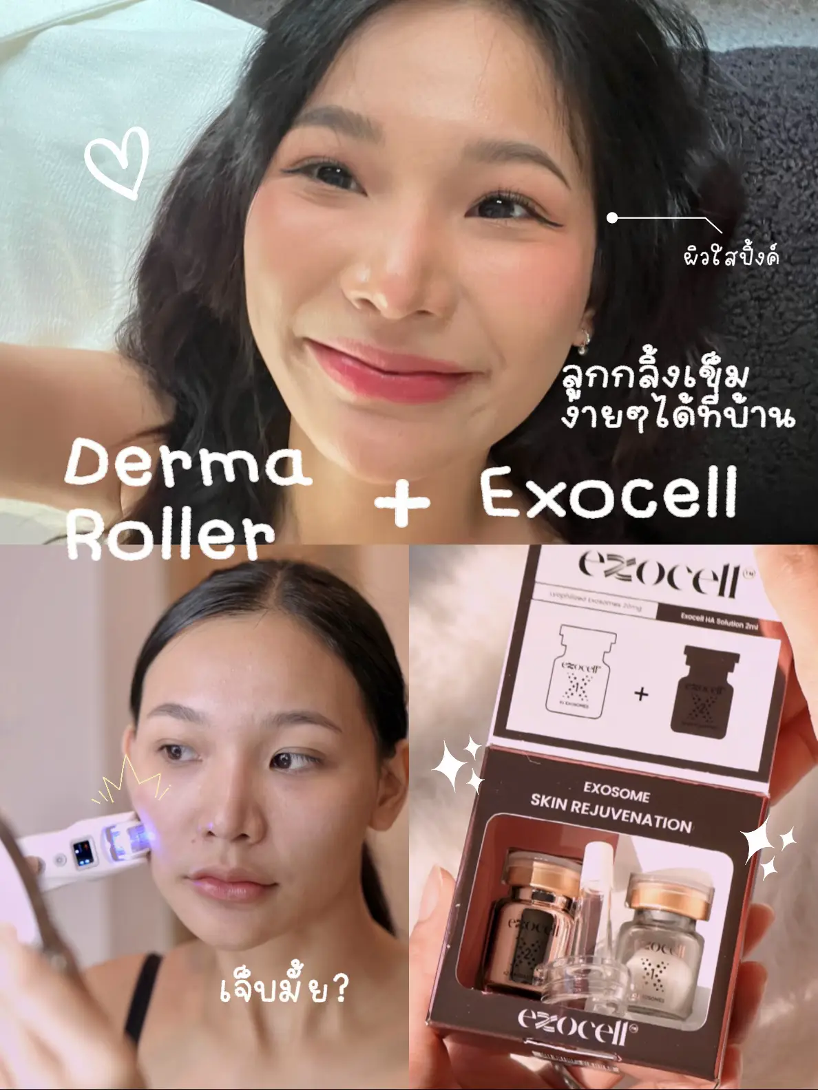 กู้ผิวด้วย Derma Roller + Exocell | แกลเลอรีที่โพสต์โดย แหนมศิริ | Lemon8