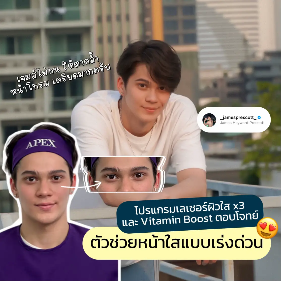 ผิวใส x3 & Vitamin Boost ต้องที่ APEX 🌟 | แกลเลอรีที่โพสต์โดย APEX BEAUTY | Lemon8