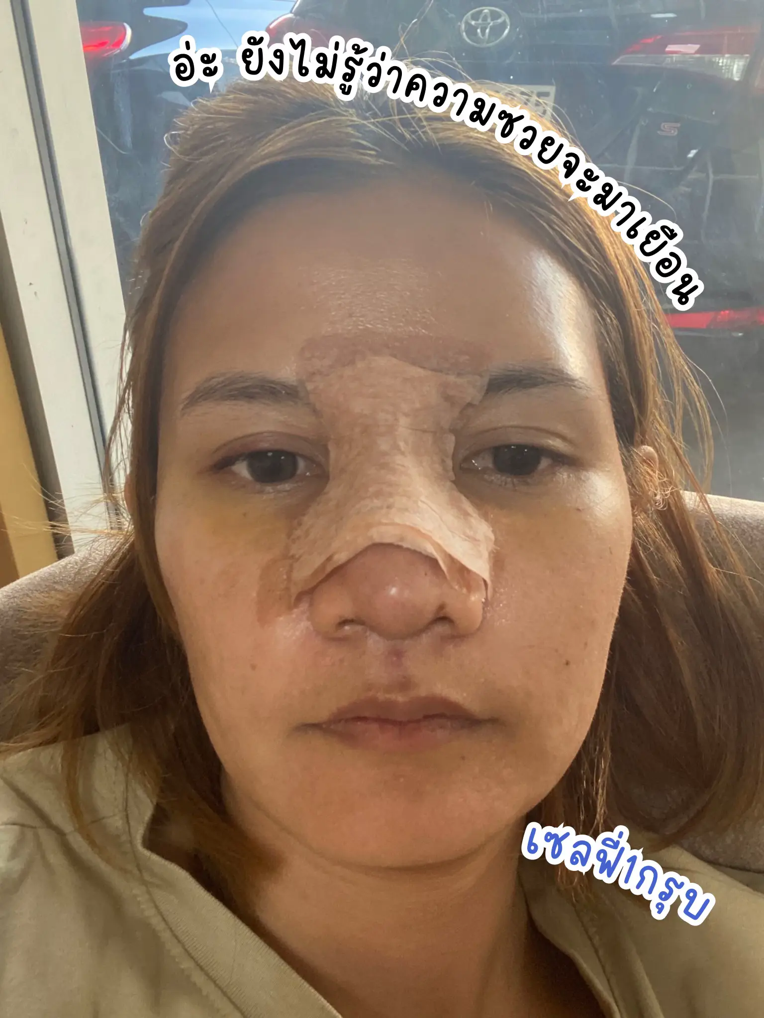 ลดบวม Proctase-P คือ ยา แก้ อะไร - การค้นหาใน Lemon8