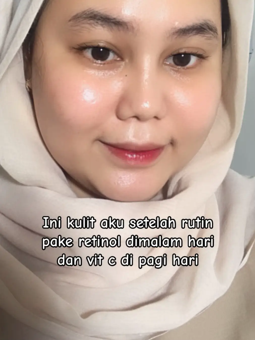 My Skin Conditions | Galeri disiarkan oleh Perempuanku23 | Lemon8