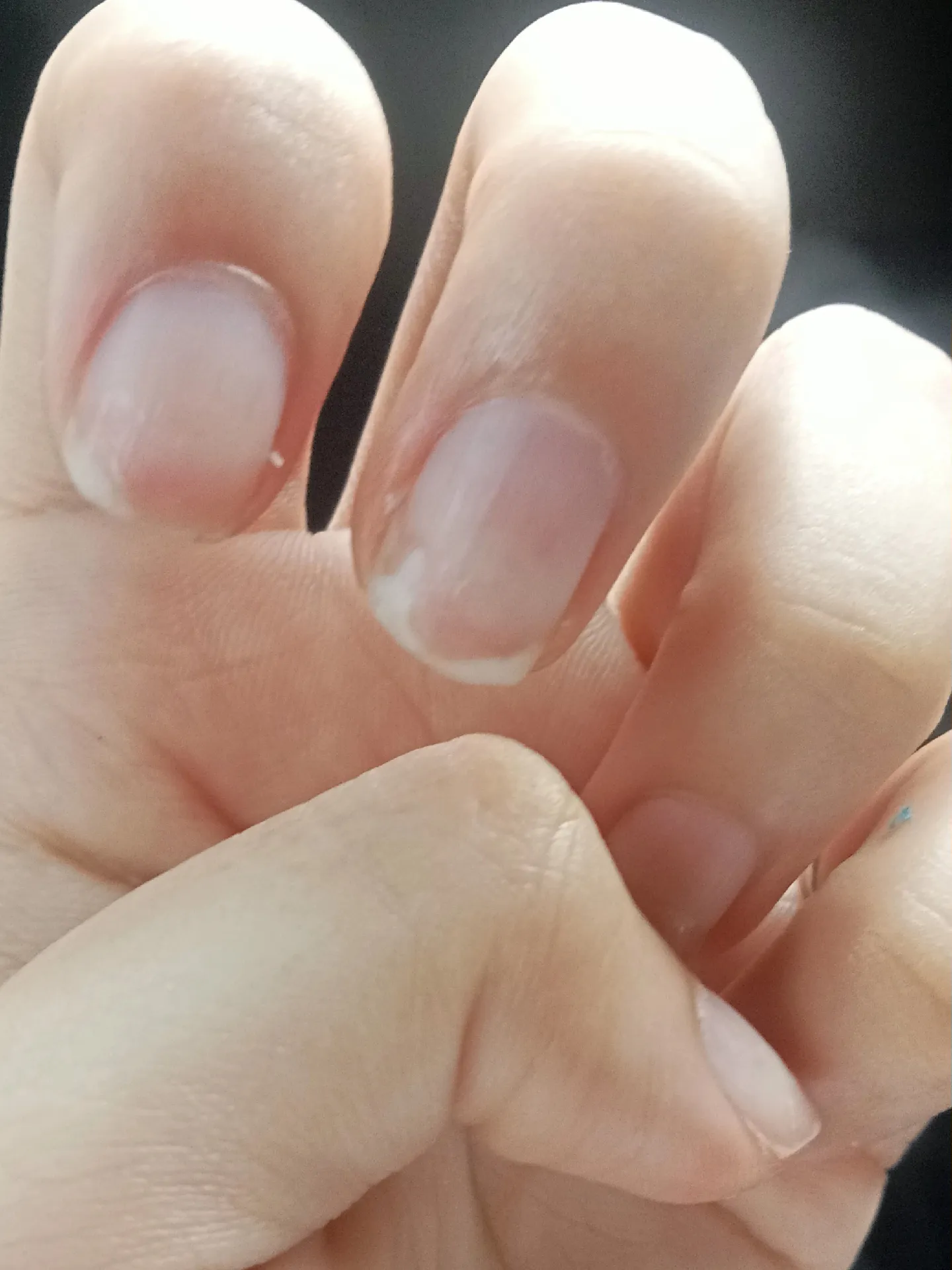 ช่วยด้วยเล็บแหว่ง!!! | แกลเลอรีที่โพสต์โดย PK | Lemon8