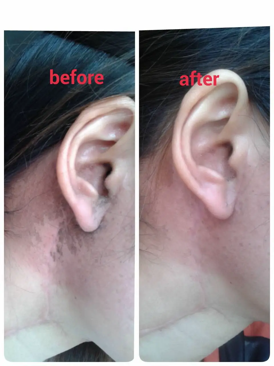 ประสบการณ์เป็นมะเร็งตอนอายุ 24 💪 | แกลเลอรีที่โพสต์โดย khuncha | Lemon8