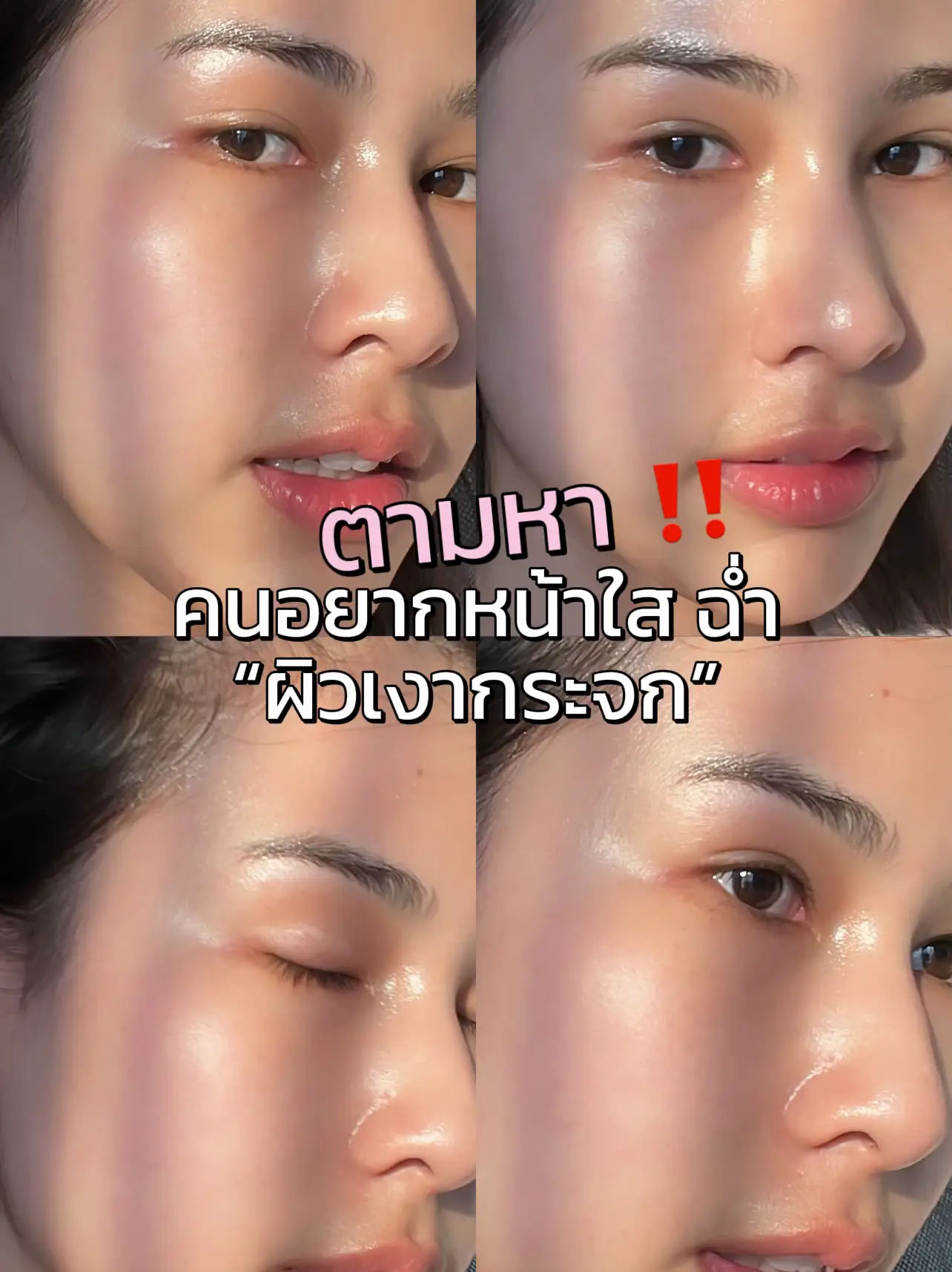 Ep.1 กู้สิวเห่อ ภายใน7วัน! (No Spon) | แกลเลอรีที่โพสต์โดย ffernfk | Lemon8