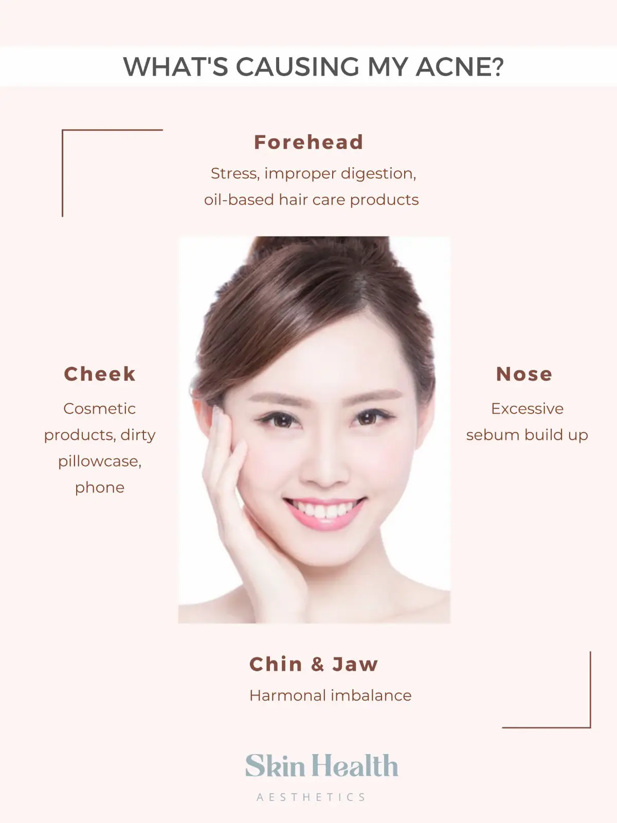 What’s causing my Acne ‼️ | Gallery posted by Skin Health | Lemon8