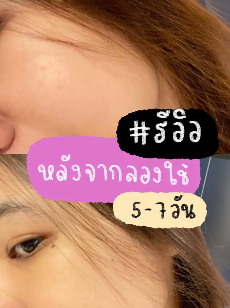 ป้ายยา MADAGASCAR Centella Skin1004 💡 | แกลเลอรีที่โพสต์โดย thisiseye | Lemon8