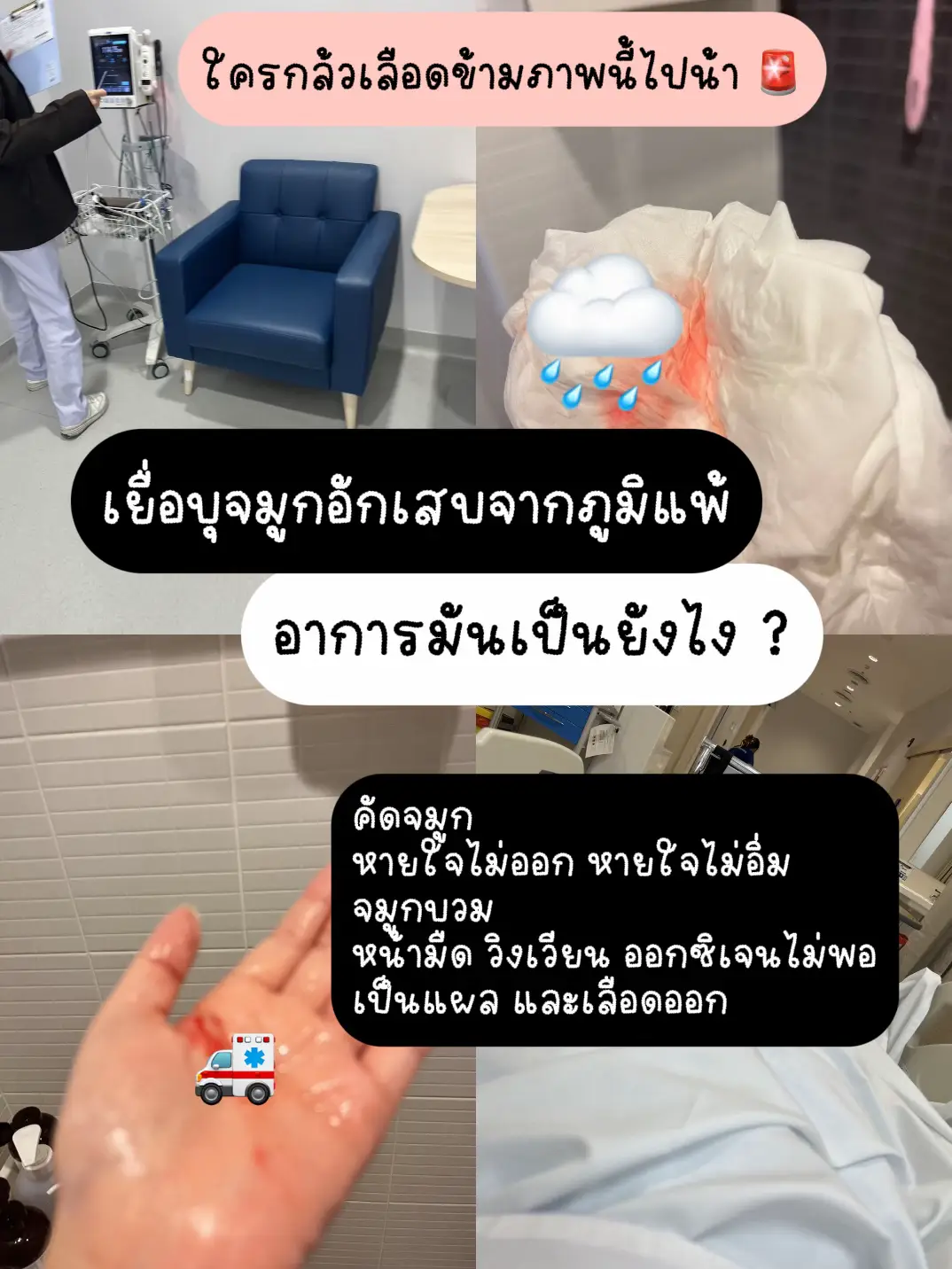 ลดบวม Proctase-P คือ ยา แก้ อะไร - การค้นหาใน Lemon8