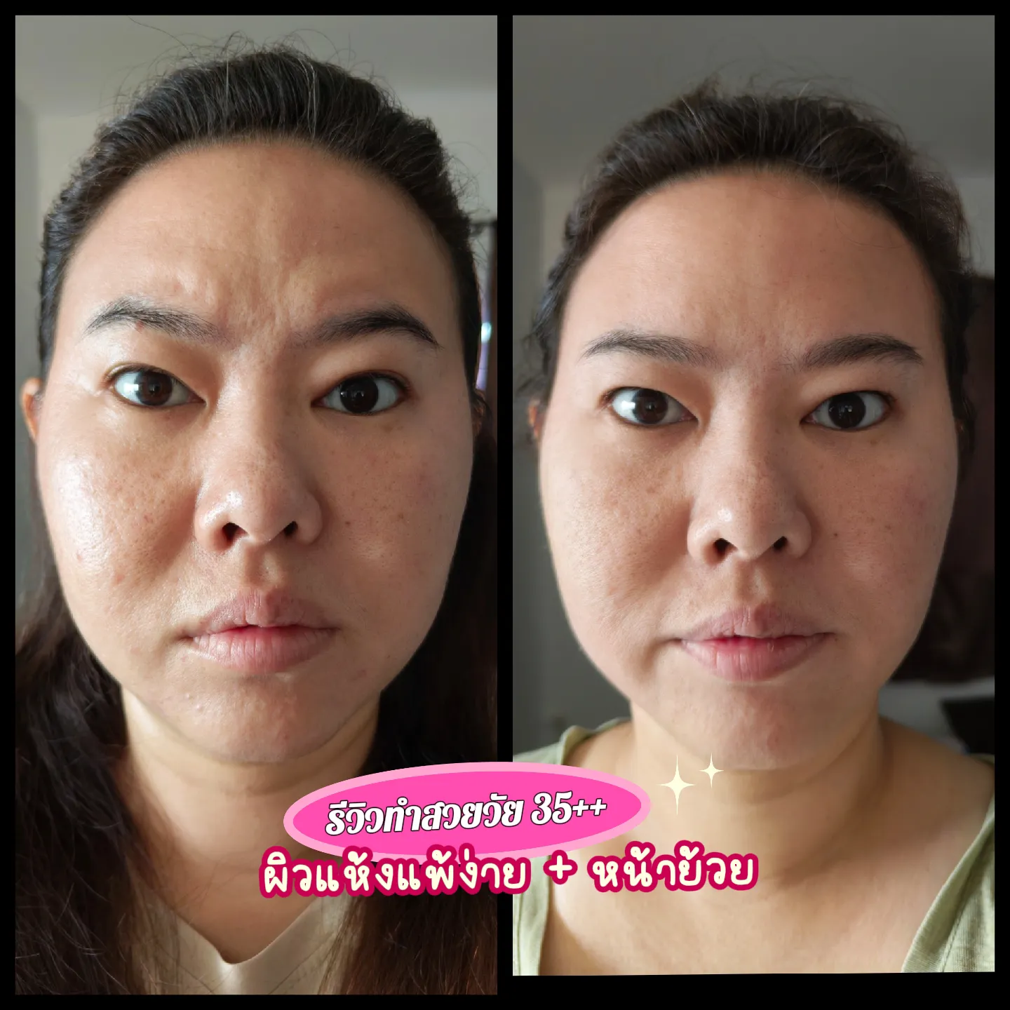 ร่วมงานเปิดตัว Hutox Botox น้องใหม่จากเกาหลี | แกลเลอรีที่โพสต์โดย Mykhannotz | Lemon8