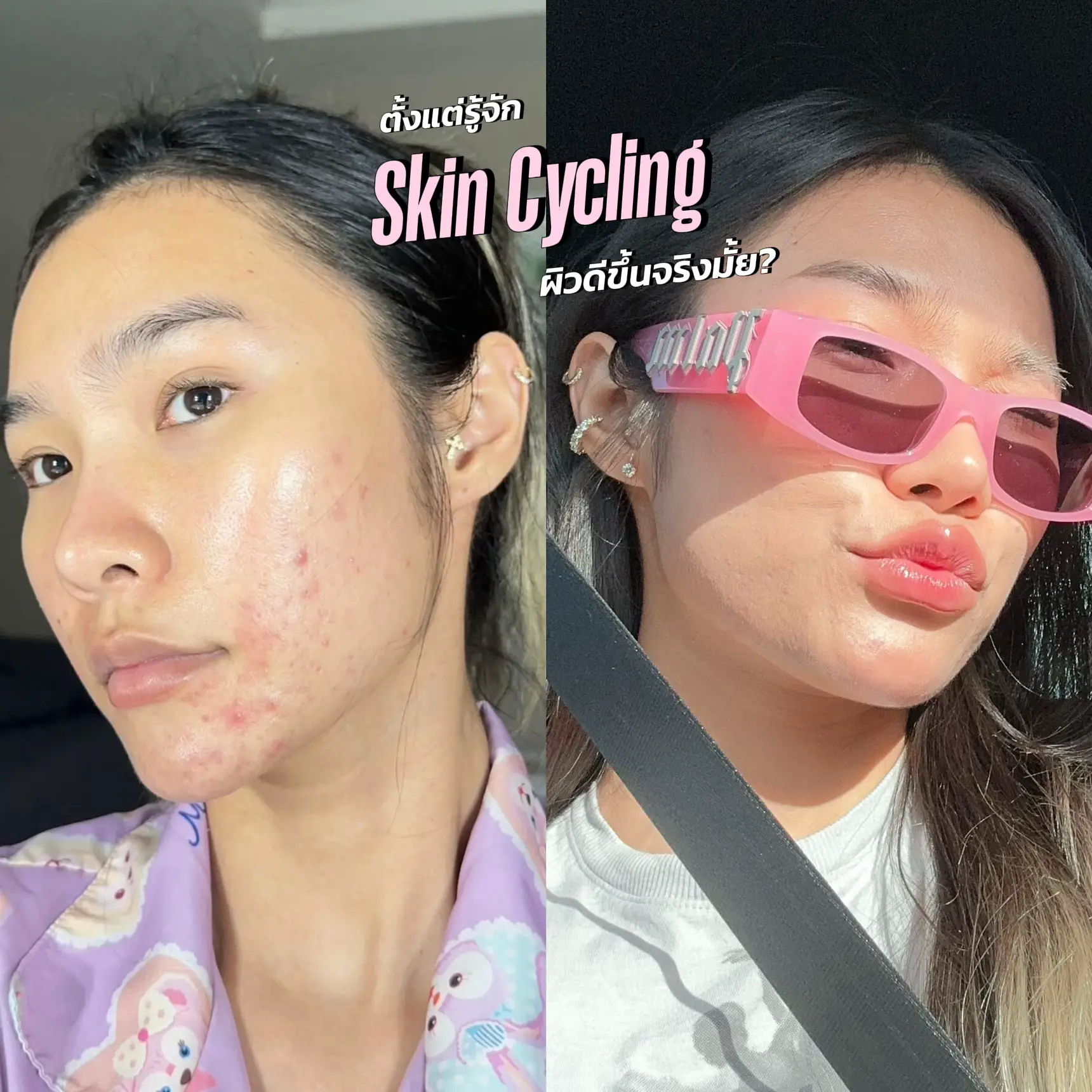 Skin cycling ทำแล้วผิวดีจริงมั้ย ? | แกลเลอรีที่โพสต์โดย amam🌷 | Lemon8