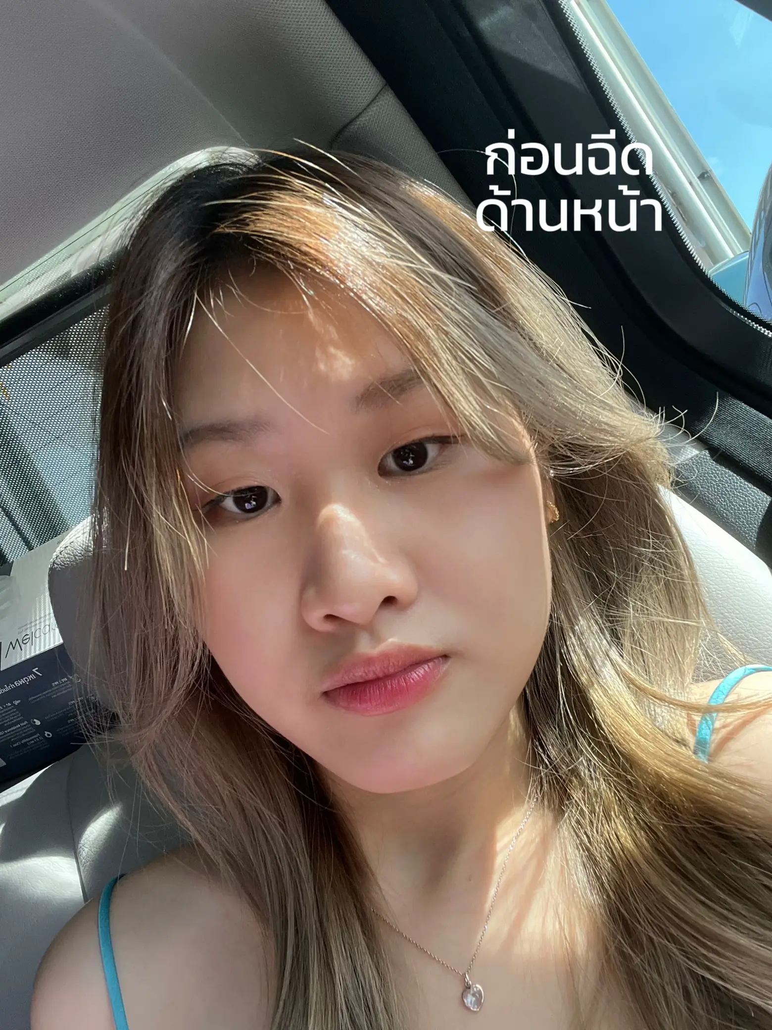 หัตถการที่จะไม่ซ้ำ | แกลเลอรีที่โพสต์โดย aomphak | Lemon8